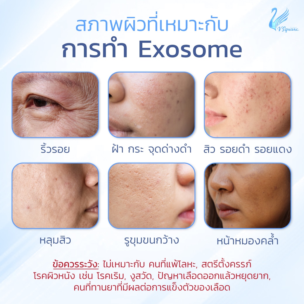 เจาะลึก exosome คืออะไร ? ทำจุดไหนได้บ้าง ? กี่วันเห็นผล