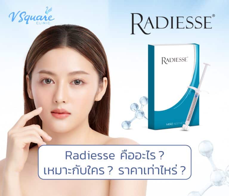 Radiesse สารกระตุ้นคอลลาเจน CaHA คืออะไร ? ราคาเท่าไหร่ ? อัปเดต 2025