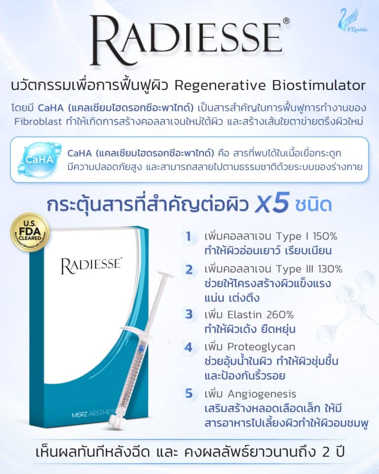 Radiesse สารกระตุ้นคอลลาเจน CaHA คืออะไร ? ราคาเท่าไหร่ ? อัปเดต 2025