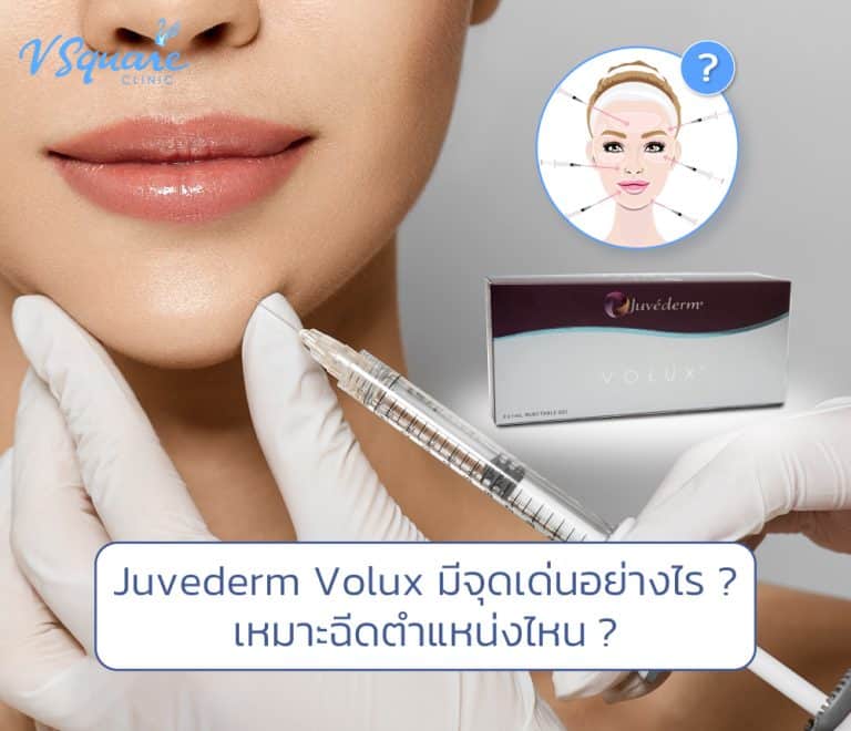 ฟิลเลอร์ Juvederm Volux สร้างมิติให้ใบหน้า พร้อมบอกลาริ้วรอยร่องลึก