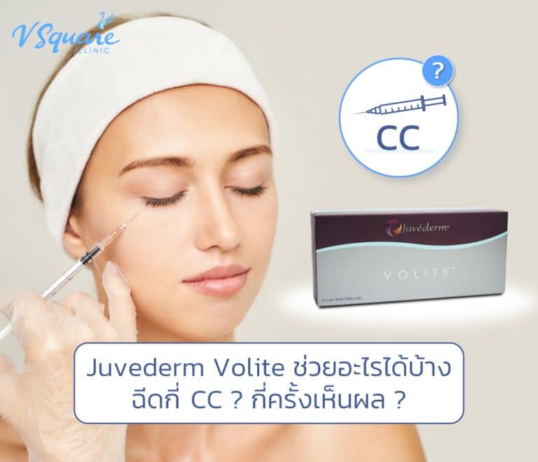 Juvederm Volite ช่วยอะไรได้บ้าง ผิวกระจก ผิวฉ่ำ ทำได้ไหม ฉีดกี่ CC