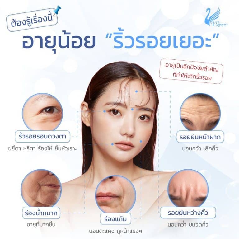 Botox Allergan โบท็อกคุณภาพสูงจากอเมริกา ที่ช่วยให้ผิวหน้าดูอ่อนเยาว์