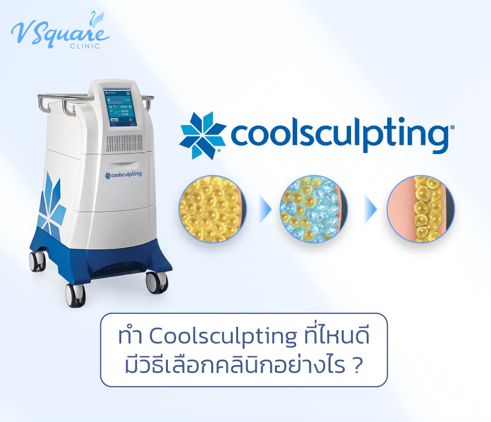 ทำ CoolSculpting ที่ไหนดี แนะนำวิธีเลือก คลินิกมาตรฐาน 2026