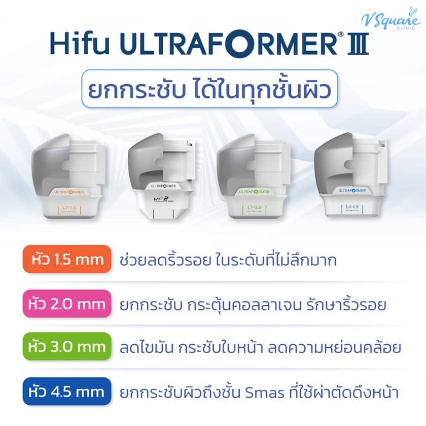 Ultraformer III เปิดคู่มือ 6 กระบวนการทำงานในการยกกระชับผิว