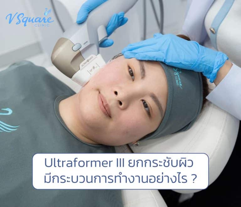 Ultraformer III เปิดคู่มือ 6 กระบวนการทำงานในการยกกระชับผิว