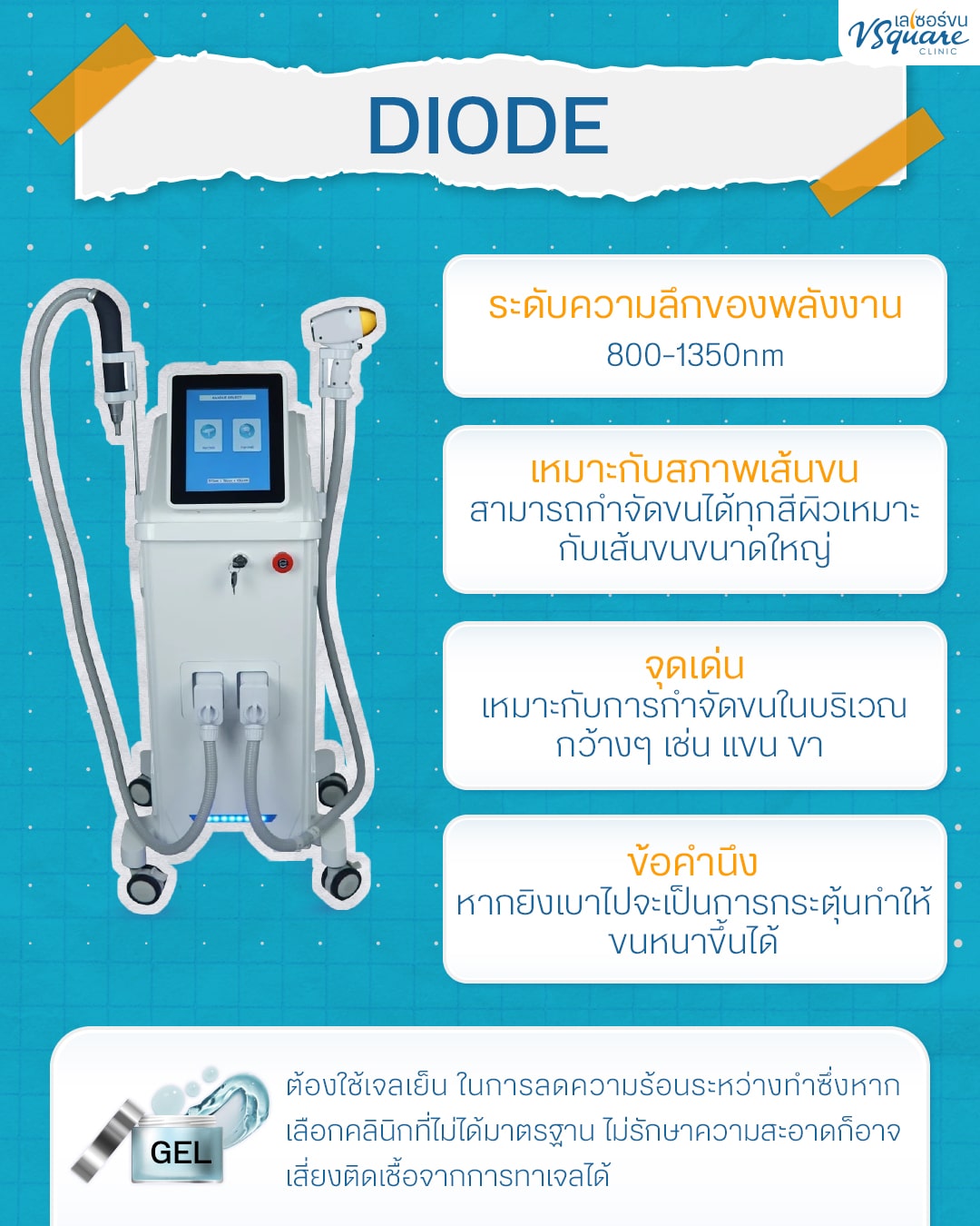 Diode Laser กำจัดขนได้ดีจริงไหม กำจัดขนจุดไหนได้บ้าง อยู่ได้นานไหม