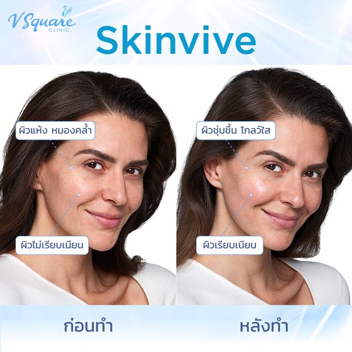 skinvive คืออะไร ? ตัวช่วยผิวฉ่ำโกลว์ ผิวสวยอ่อนเยาว์เร่งด่วน