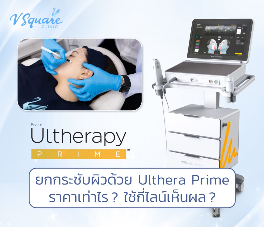 Ulthera Prime ราคาเท่าไหร่ ? เจาะลึกทุกปัจจัย ก่อนตัดสินใจทำ