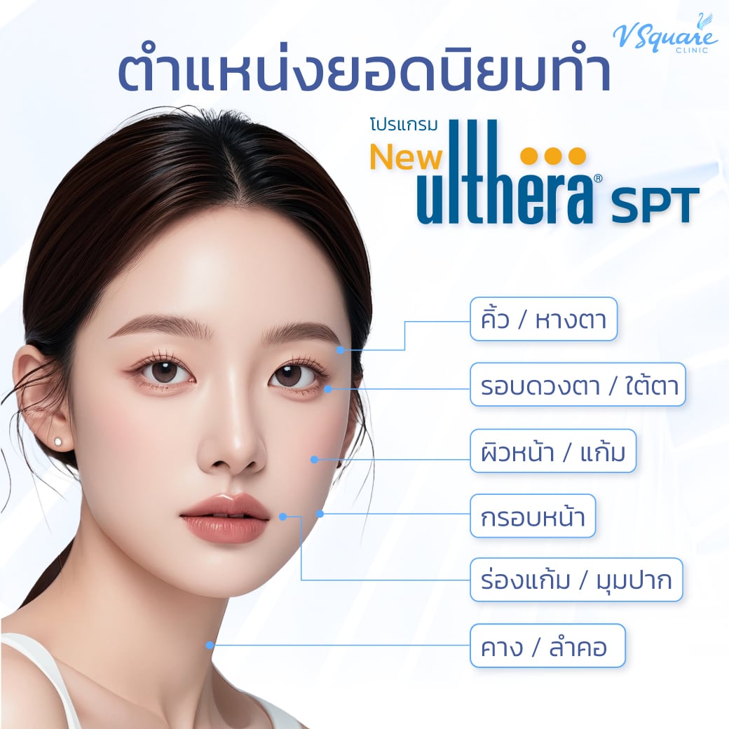 Ulthera SPT คืออะไร ? ดีไหม ? รู้ข้อดี ผลลัพธ์ ราคาล่าสุด
