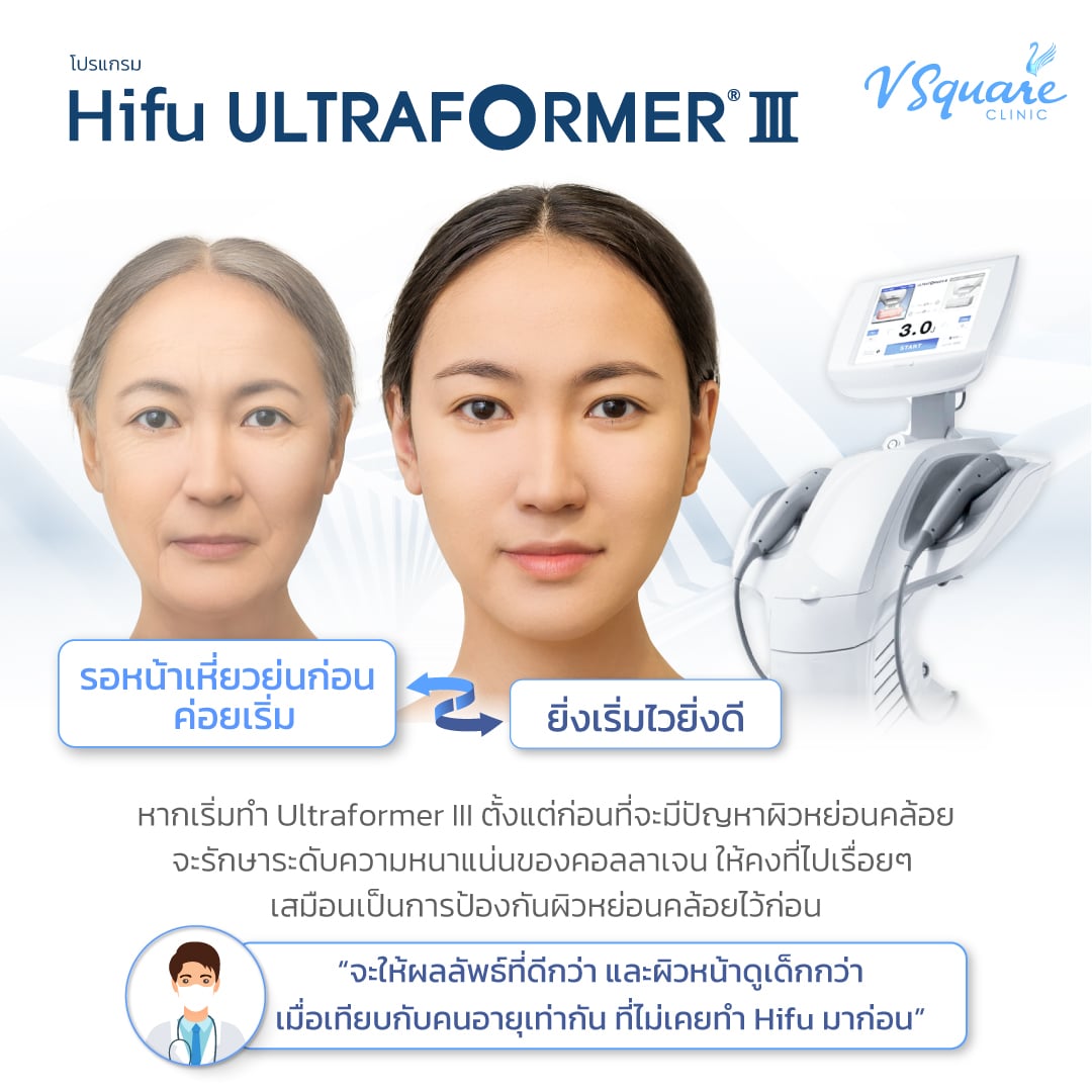 Ultraformer III ช่วยอะไร ทำแล้วหน้าเรียวไหม กี่วันเห็นผล