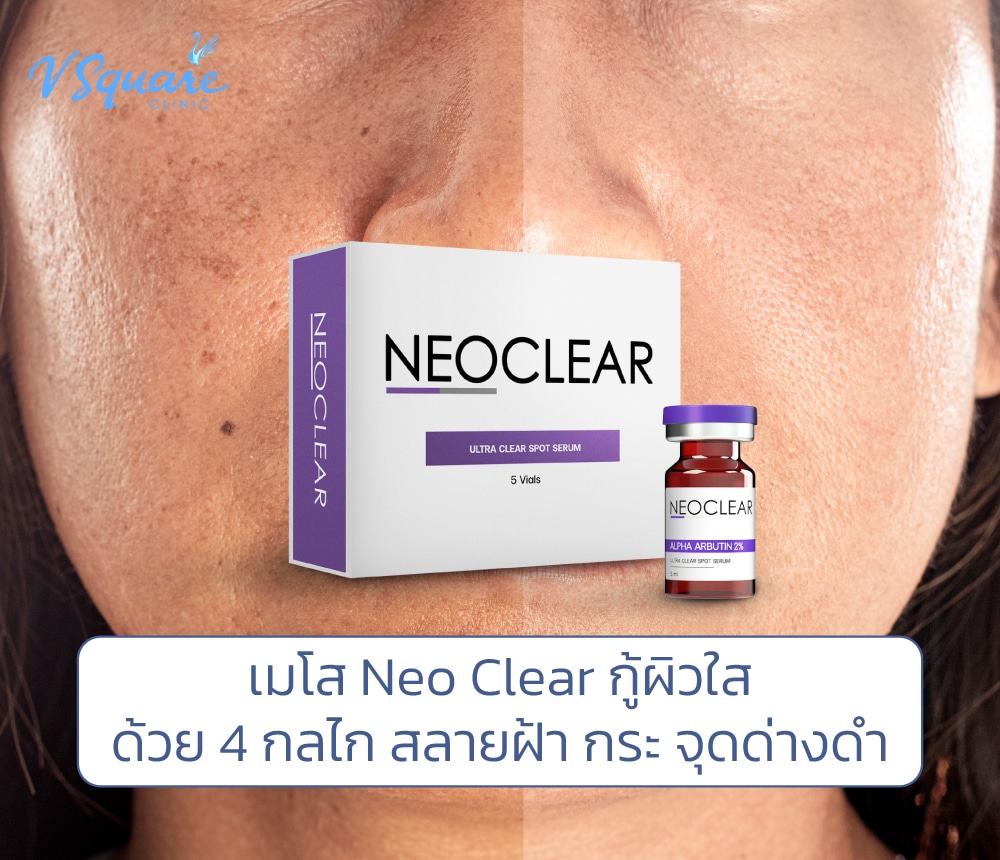 เมโส Neo Clear สลายฝ้าได้อย่างไร เจาะลึก 4 กลไกฟื้นฟูผิวขาวใส