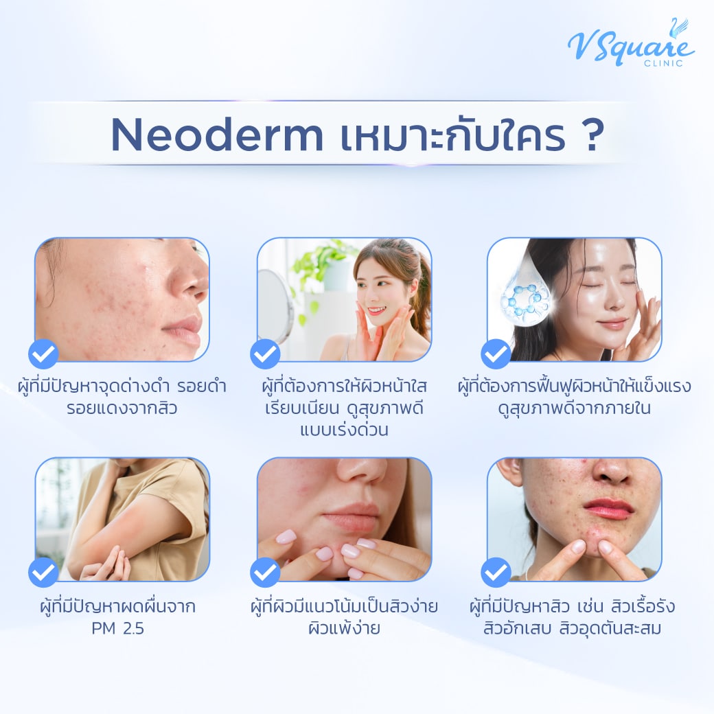 เมโส Neo Derm นวัตกรรมดีท็อกซ์ผิว ลดสิว ฟื้นฟูผิวแข็งแรง